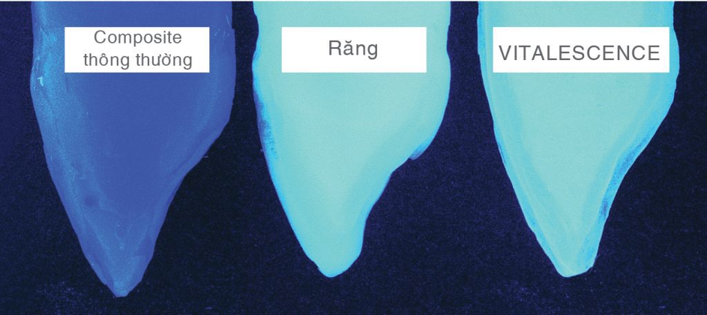 Mua Vitlescence Composite - Composite Trám Thẩm Mỹ ️ VAT đầy đủ