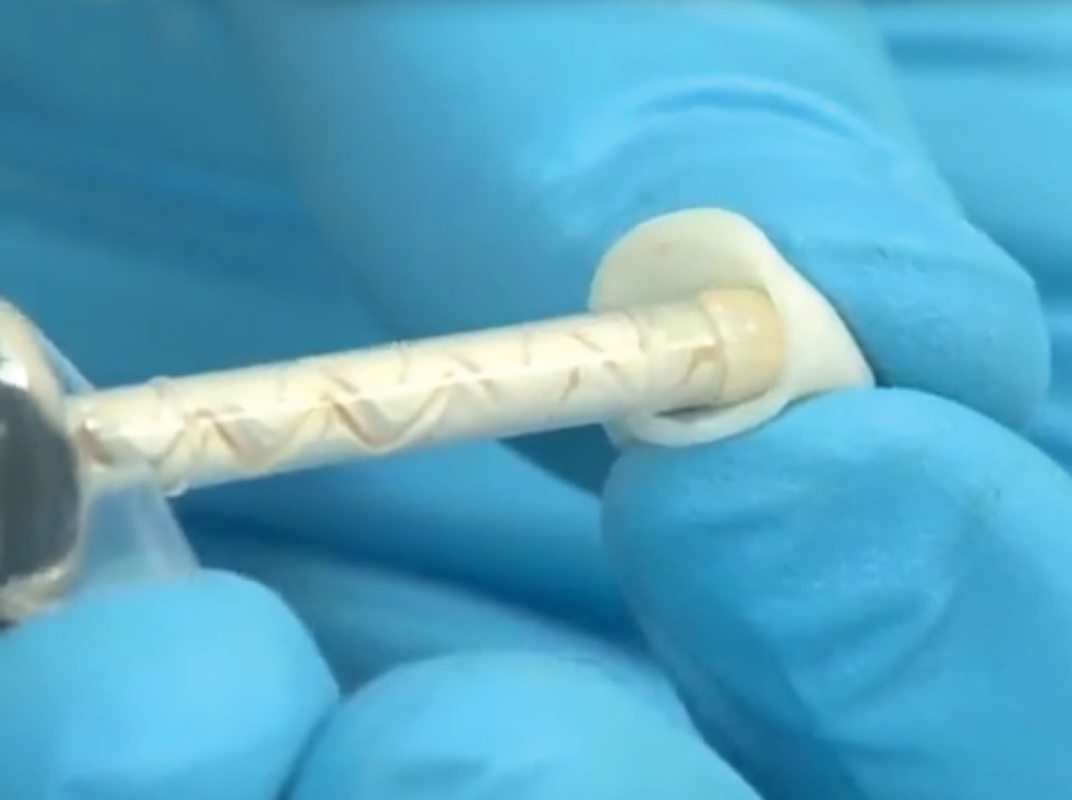 Mua Xi Măng Tạm - Ultratemp Tempo Cement & Ultratemp Rez Tempo Cement ️ ...