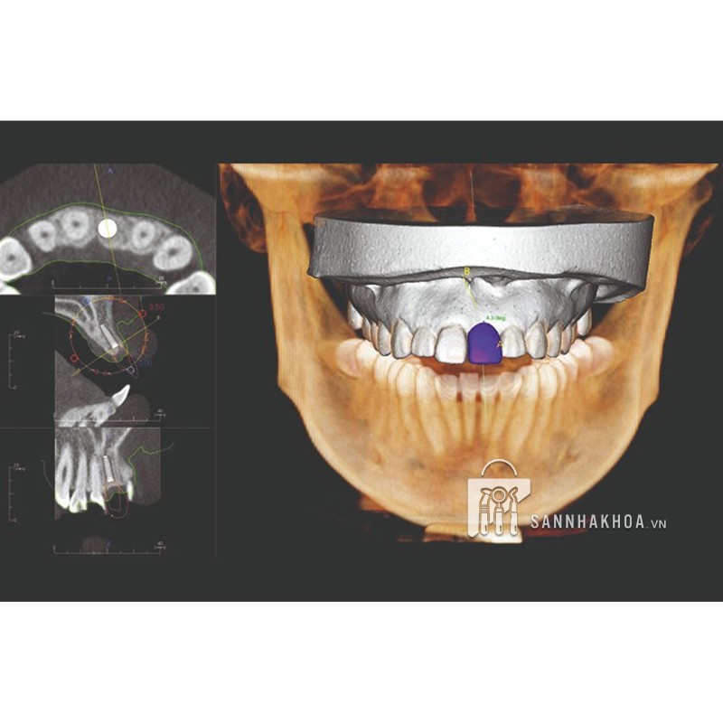 Mua Máy Chụp Ct Kavo Op 3D Vision Kavo Dental Technology ️ VAT đầy đủ