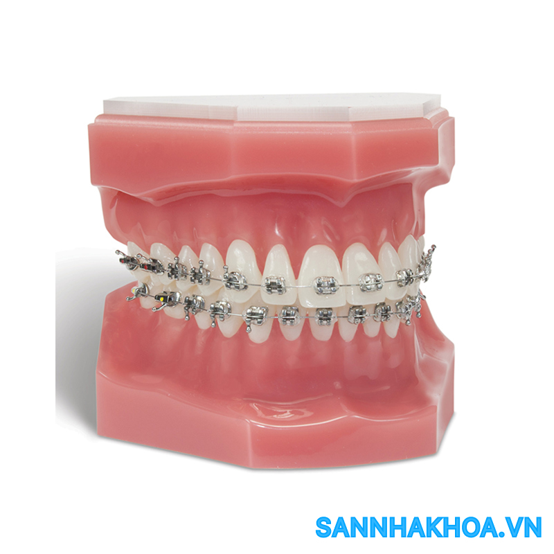 Mua Mẫu Hàm Măc Cài Tư Vấn Masel ️ VAT đầy đủ