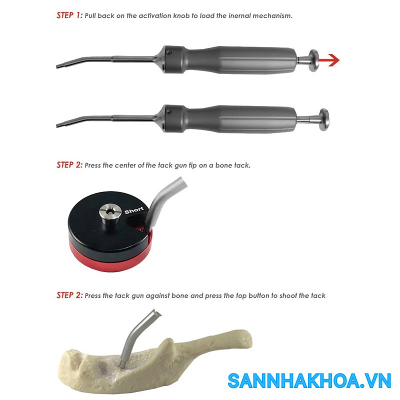 Mua Bộ Dụng Cụ Định Hình Màng Titan Tbm-05 - Auto Bone Tac Mini Set Mctbio ️ VAT đầy đủ