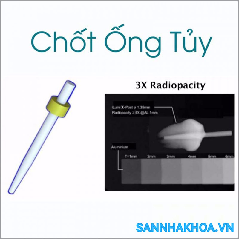 Chốt Sợi Thủy Tinh Ilumi - Cường Độ 1000 Mpa Sàn Nha Khoa Lớn Nhất VN